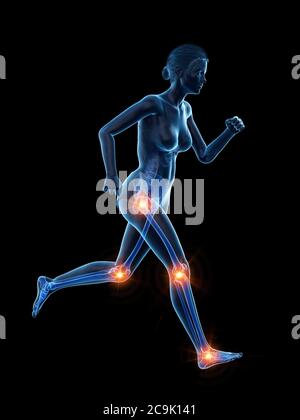 Joint pain while walking, illustration Stock Photo - Alamy