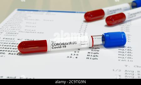 Negative test result by using rapid test device for COVID-19. 3d ...