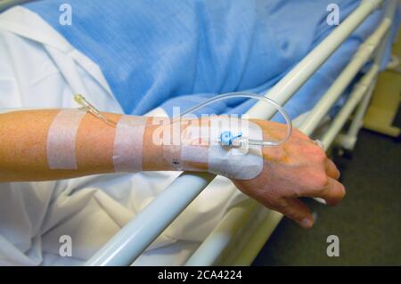 An Intravenous (IV) Cannula in the arm, Healthcare and medical Stock ...