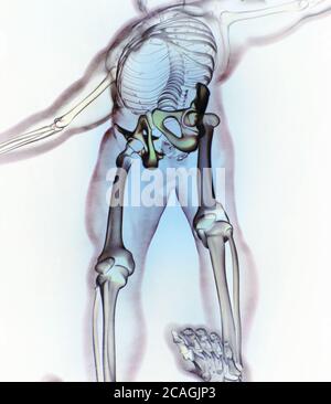Illium bone, hip bone or pelvis. Human anatomy, bone skeletal structure ...