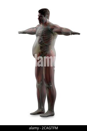 Overweight human obese anatomy. Diabetes. Heart disease. 3D ...