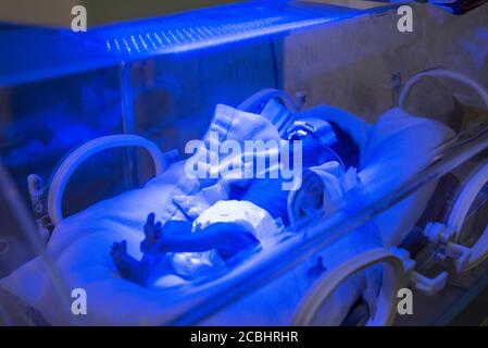 Newborn baby in an incubator with blue light for jaundice in the ...