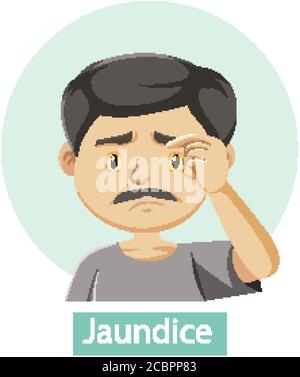 Cartoon character with jaundice symptoms illustration Stock Vector ...
