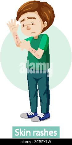Cartoon character with skin rashes symptoms Stock Vector Image & Art ...