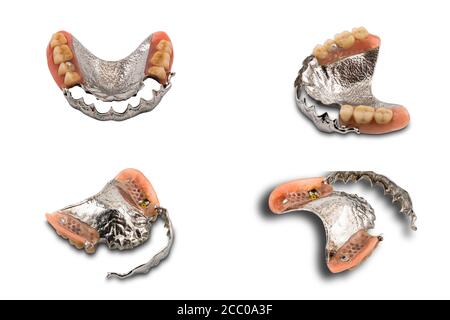 Partial metal removable swinglock denture isolated on white background ...