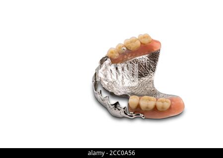 Partial metal removable swinglock denture isolated on white background ...
