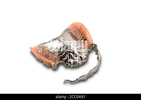Partial metal removable swinglock denture isolated on white background ...