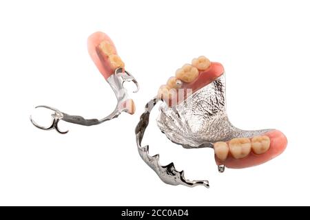 Partial metal removable swinglock denture isolated on white background ...