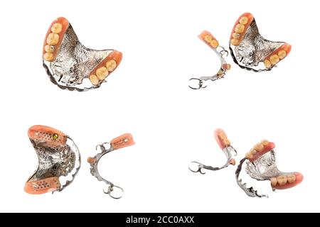 Partial metal removable swinglock denture isolated on white background ...