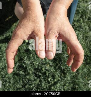 Calluses on the hands, Close-up of male hands. High quality photo Stock ...
