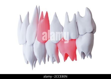 3d render of upper jaw with teeth and dental premolar implant over ...