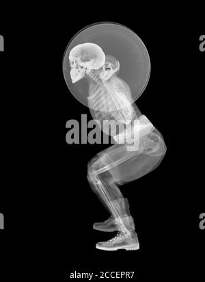 Skeleton weightlifter, X-ray Stock Photo - Alamy
