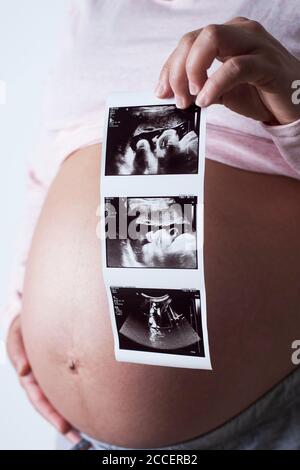 Hands holding ultrasound scans of a baby isolated on white background ...
