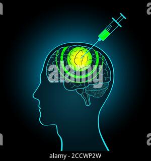 A syringe injection into the brain of a truth serum straightening out ...
