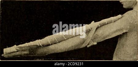 . Minor surgery and bandaging; including the treatment of fractures and ...