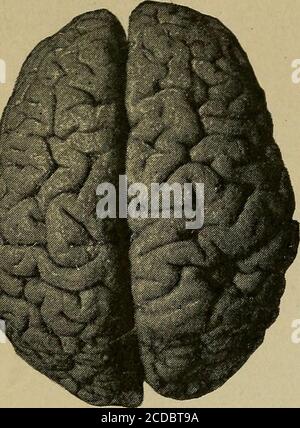 Brain: view from above, showing the gyri, with one hemisphere covered ...