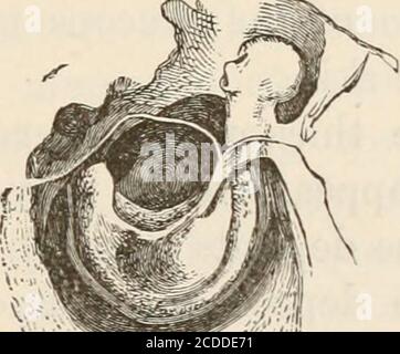 . The pathological anatomy of the ear . t of the membrane in the ...