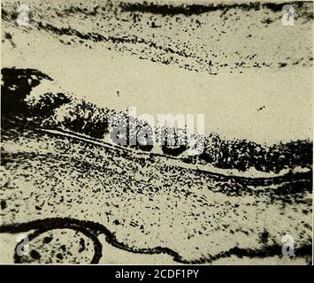 Human red blood cells within a fibrin meshwork Stock Photo - Alamy