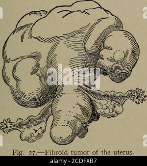 . A reference hand-book of gynecology for nurses . n each cornu. The ...