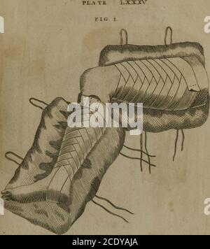 . A system of surgery (Volume 4) . FIG. 3 Stock Photo - Alamy