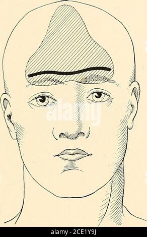 . Regional anesthesia : its technic and clinical application . al block ...