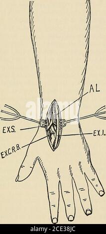 Operative surgery, for students and practitioners . Pig. 110.—Double ...