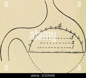 Operative surgery, for students and practitioners . he size of the ...