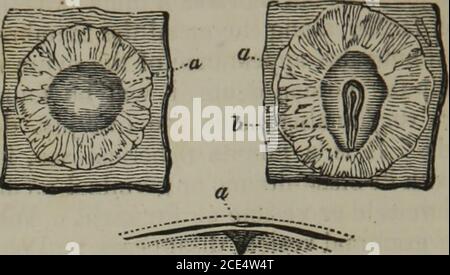 . On the theory and practice of midwifery . l membrane is the formation ...