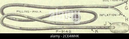 . The Canadian nurse . P-^!42—Miller-Abbott double lumen tube, similar ...