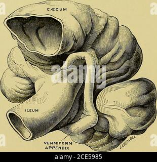 . A contribution to the pathology of the vermiform appendix . so-colon ...