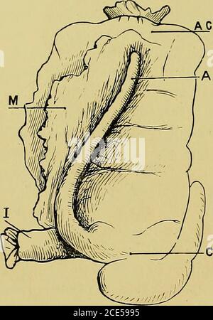 . A contribution to the pathology of the vermiform appendix . so-colon ...