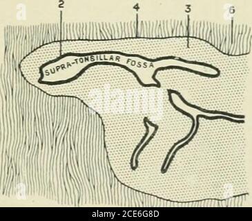 . Journal of anatomy . Fig. 5. —Tonsil of female aged 20, showing three ...