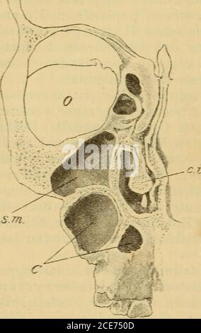 . Pathologie und Therapie der entzündlichen Erkrankungen der ...