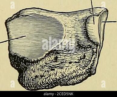. Quain's Elements of anatomy. Fig. 150. —Right external cuneiporm bone ...