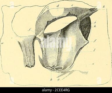 . The anatomy and surgical treatment of hernia. f9 Stock Photo - Alamy