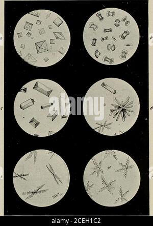 Crystals of Uric acid (a), Calcium oxalate (b) and fermentation of the ...