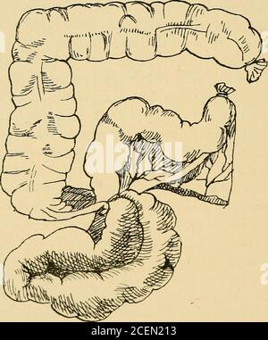 On retro-peritoneal hernia . Jonnesco, and 53 per cent, byEccles. My ...