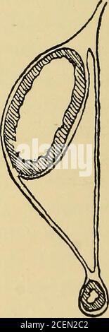 . On retro-peritoneal hernia . the ileo-colic artery is continued down ...