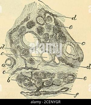 . Anatomy, descriptive and surgical. Upper portion of the thymus of ...