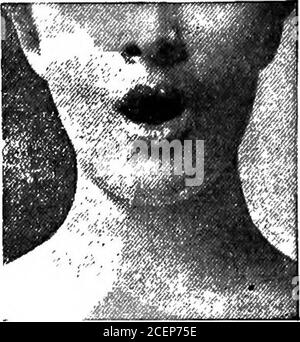 . Resonance in singing and speaking. Figure 2. Figure 3 Stock Photo - Alamy