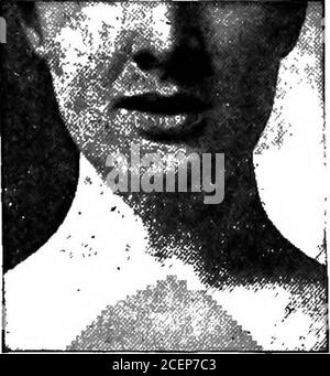 . Resonance in singing and speaking. Figure 2. Figure 3 Stock Photo - Alamy
