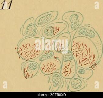 . Lehrbuch der speziellen pathologischen Anatomie für Studierende und ...