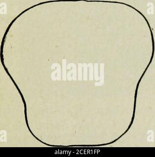 . The diseases of infancy and childhood. Deformity of the Chest in ...