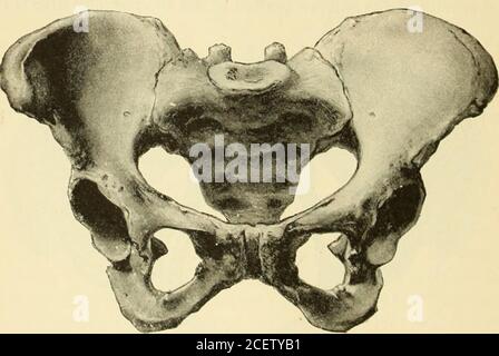 The male pelvis, as seen from the front, is outlined by the sacrum and ...