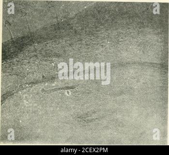 The Journal of laryngology and otology . anterior and inferior part of ...