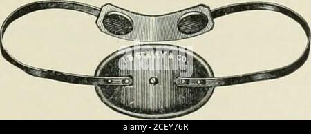 . Abdominal hernia : its diagnosis and treatment. 3. Double elastic ...