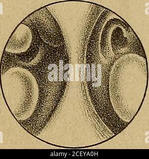 . Deformities of the mouth : congenital and acquired, with their ...