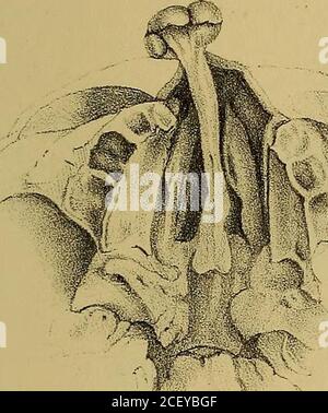 . Deformities of the mouth : congenital and acquired, with their ...