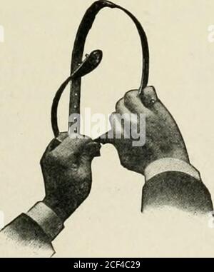 . Abdominal hernia : its diagnosis and treatment. 3-Shaping truss ...