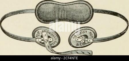 . Abdominal hernia : its diagnosis and treatment. 3. Double elastic ...